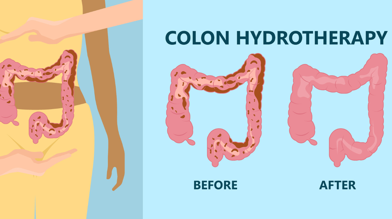 Colon Hydrotherapy In 2025: Benefits & Risks